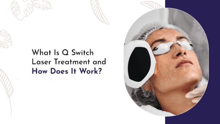 Q Switch Laser Treatment: Effective Solution for Skin Concerns