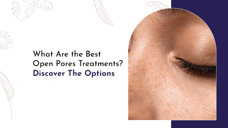 Best Open Pores Treatment Options: Effective Solutions