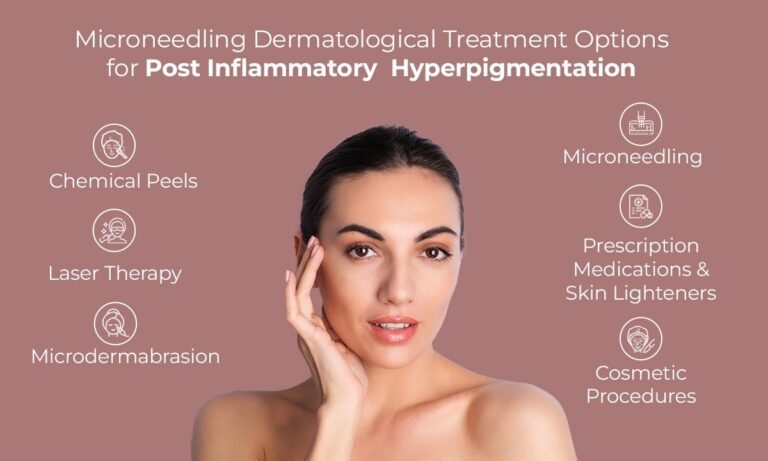 Post Inflammatory Hyperpigmentation Treatment for Clear Skin