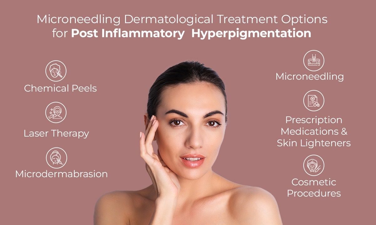 Post Inflammatory Hyperpigmentation Treatment for Clear Skin